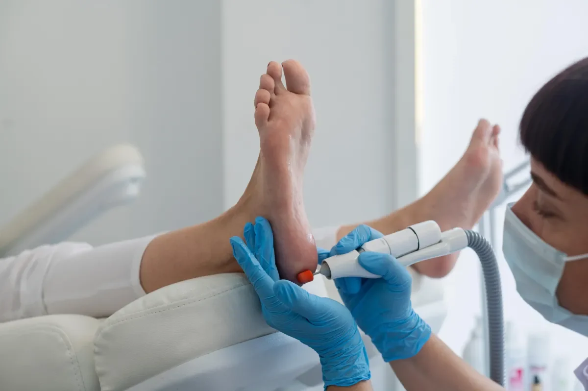 Neurovascular Corns - South Dublin Podiatry